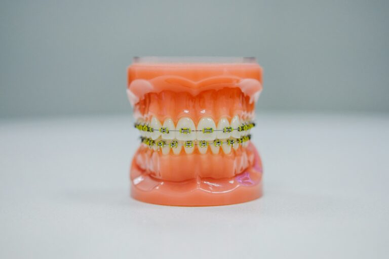 How To Care For Braces: Post Orthodontic Care Guide